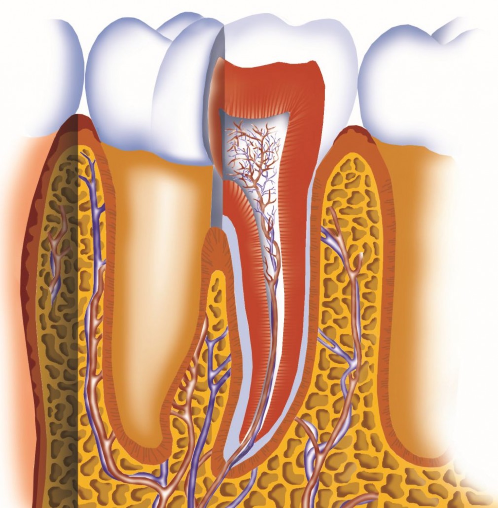 Parodontitis - Zahnarzt Wuppertal Thomas Kuboth